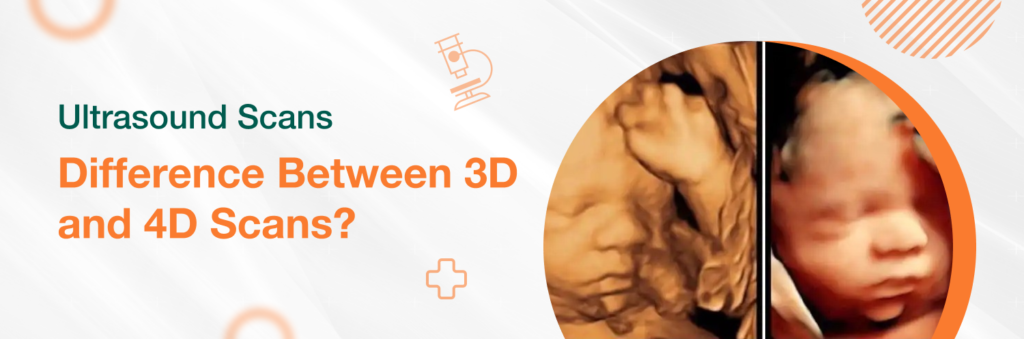 Difference Between 3D and 4D Ultrasound Scans | Samyuktha Healthcare & Diagnostics in Chennai